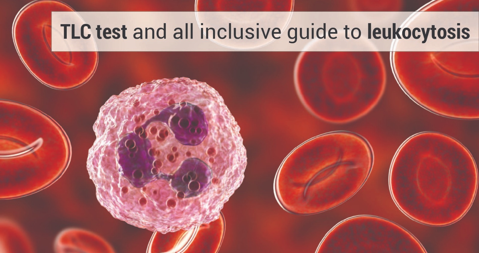 TLC test and all inclusive guide to leukocytosis | Manipal TRUtest TLC test and all inclusive guide to leukocytosis | Manipal TRUtest